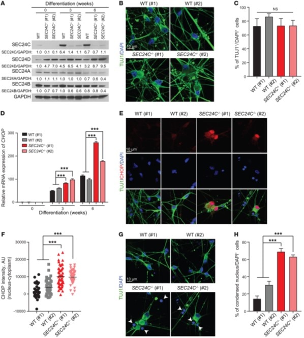 DAPT | Neural Stem Cells | Tocris Bioscience